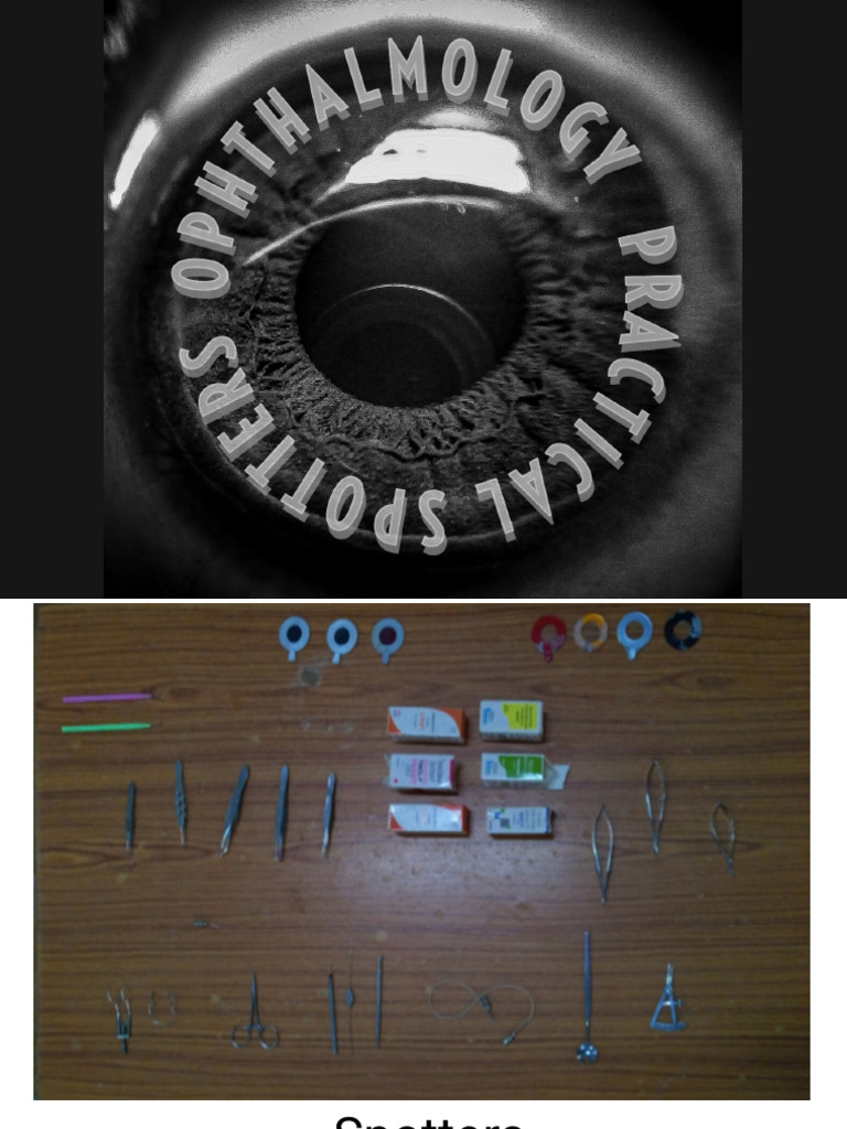 Ophthalmology Practical | PDF | Ophthalmology | Human Eye