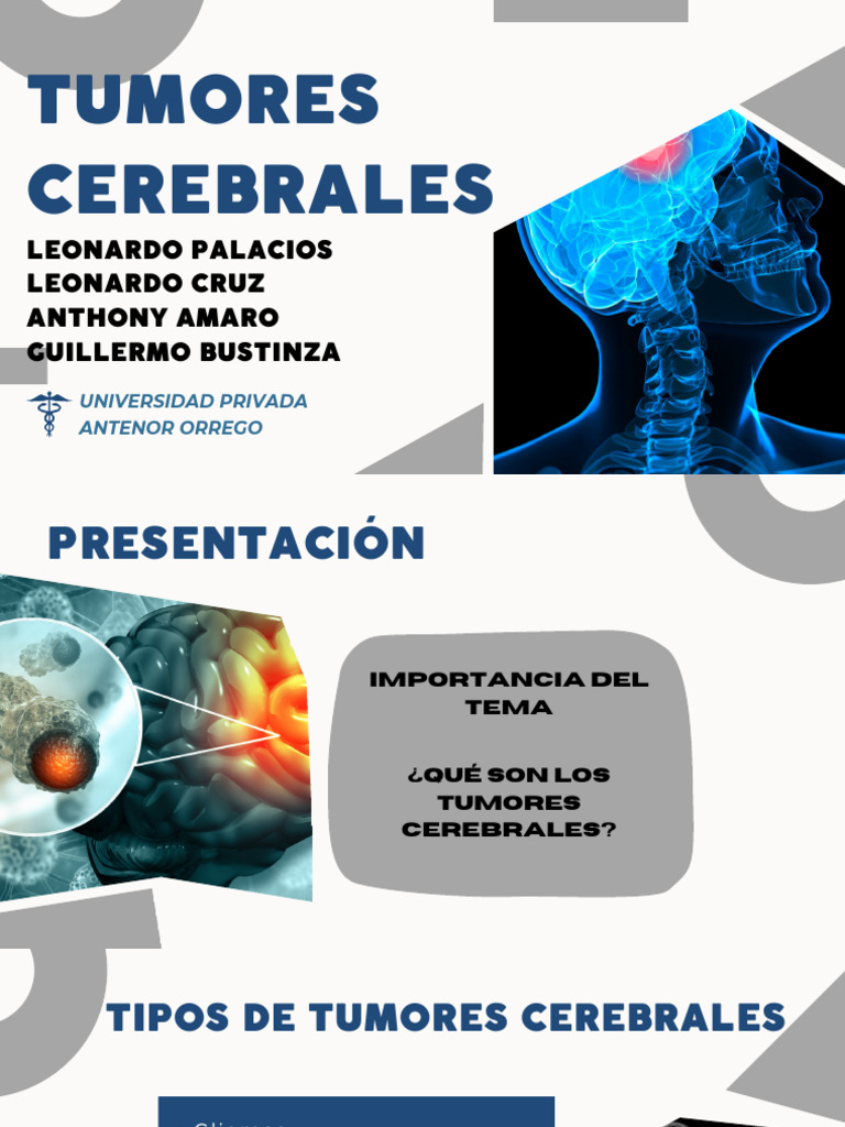 Tumores Cerebrales | PDF | Cáncer | Tumor cerebral
