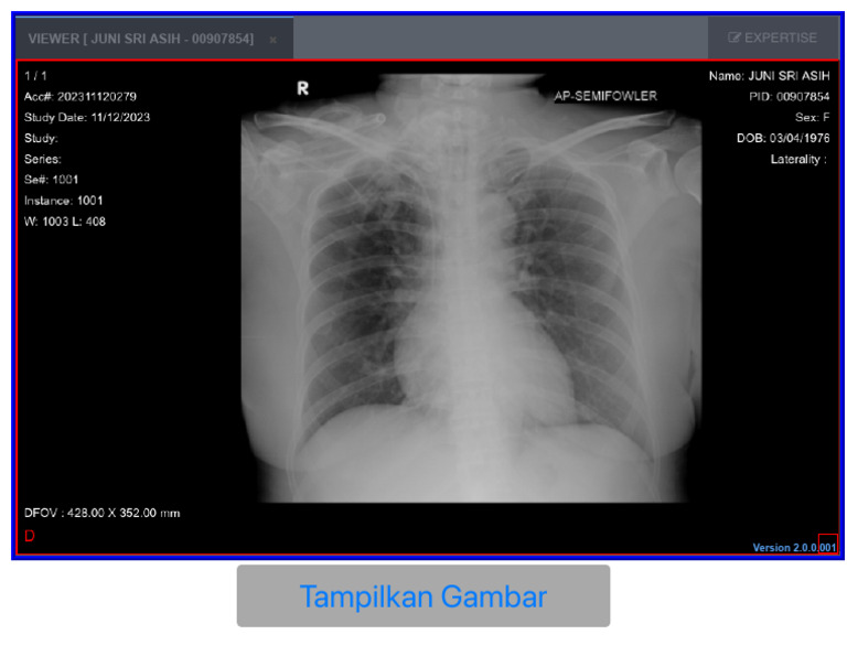 Ferizza Rics Patient Viewer 3 | PDF