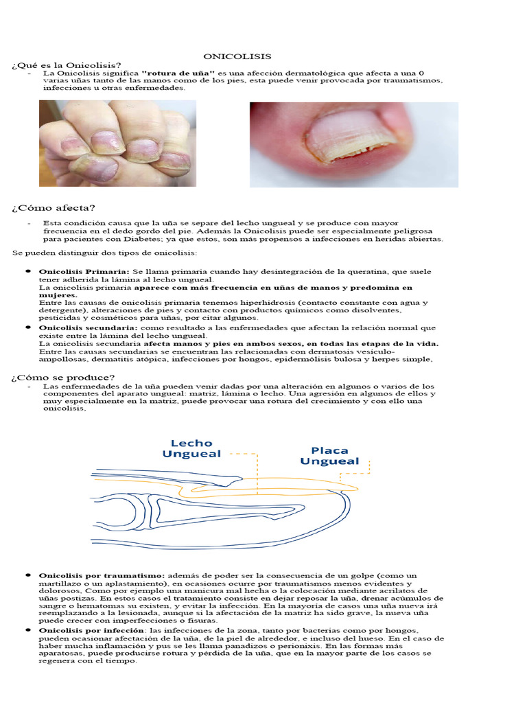 Onicolisis: Causas y Tratamientos | PDF | Clavo (anatomía) | Cáncer