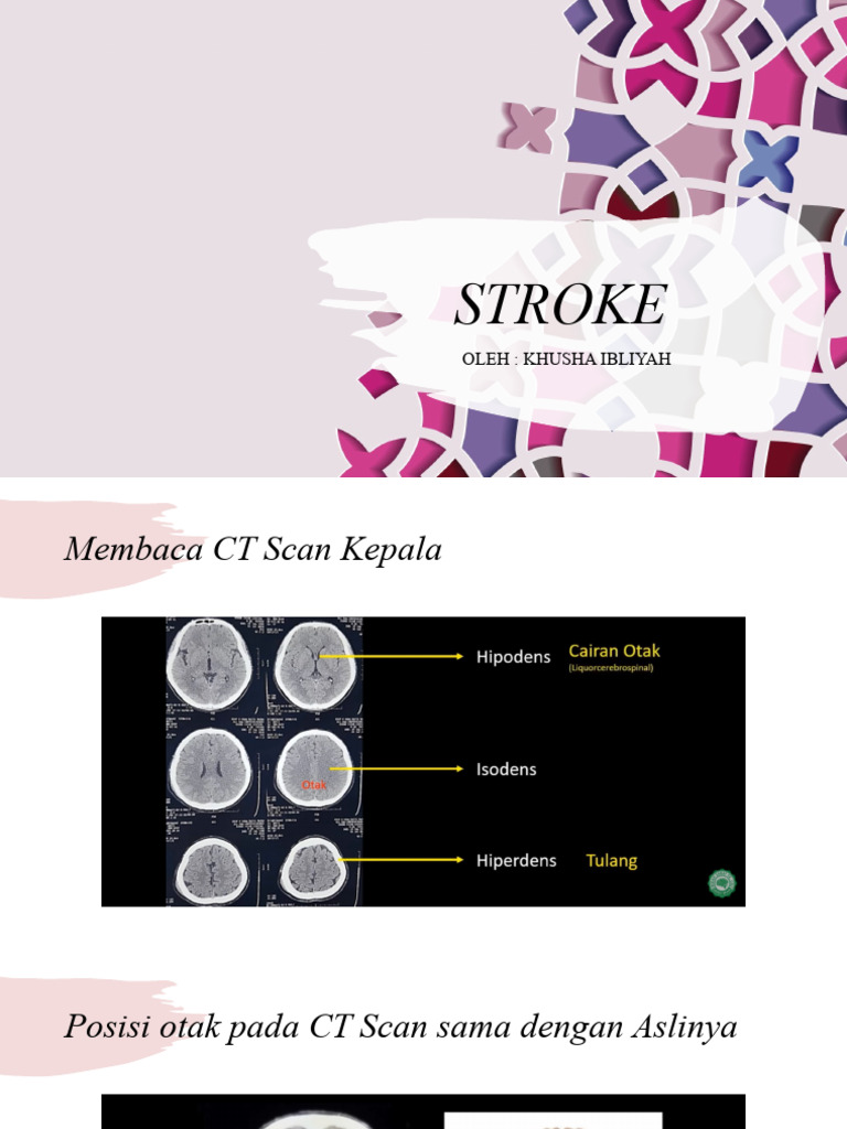 Stroke | PDF | Sains & Matematika