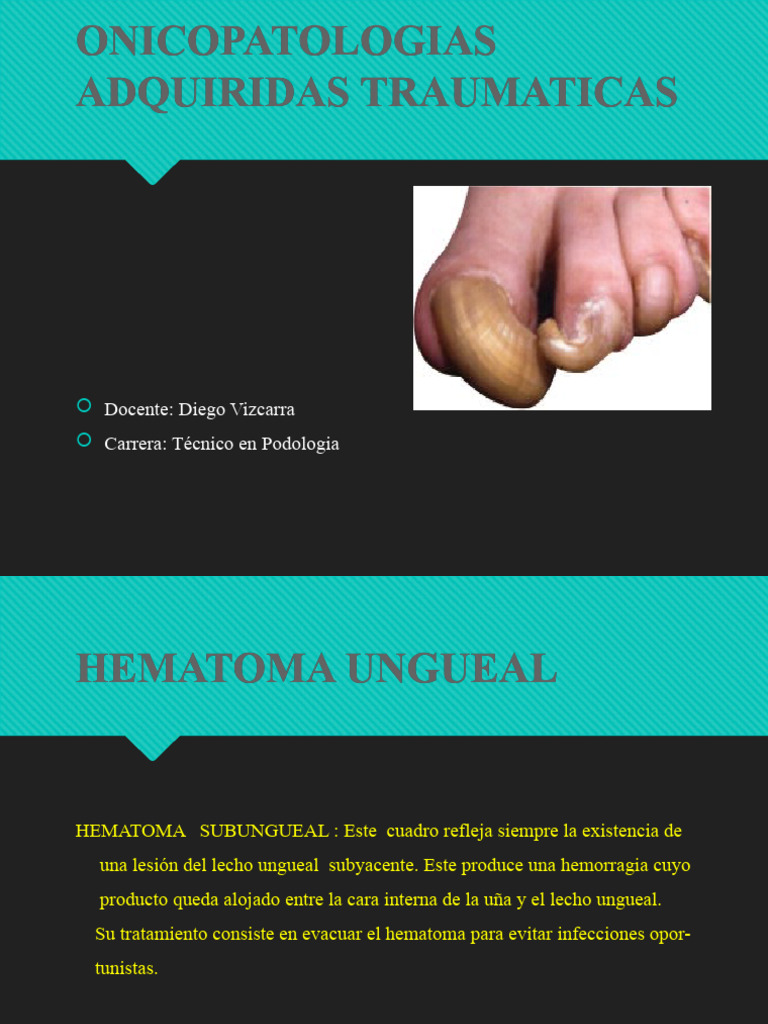 Onicopatologías Traumáticas en Uñas | PDF | Clavo (anatomía) | Medicina ...