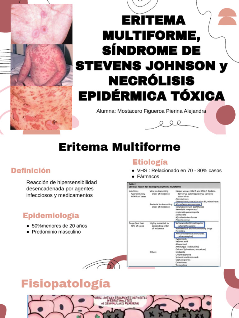 Eritrea Multiforme-Ssj-Net | PDF | Piel | Dermatología