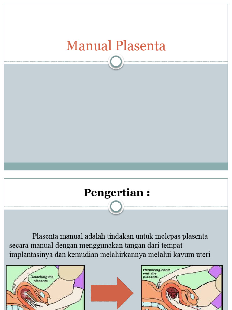 Materi Praktek Manual Plasenta | PDF