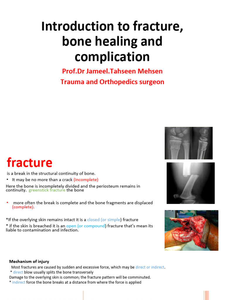 Introduction To Fracture, Bone Healing and Complication: Prof - DR ...