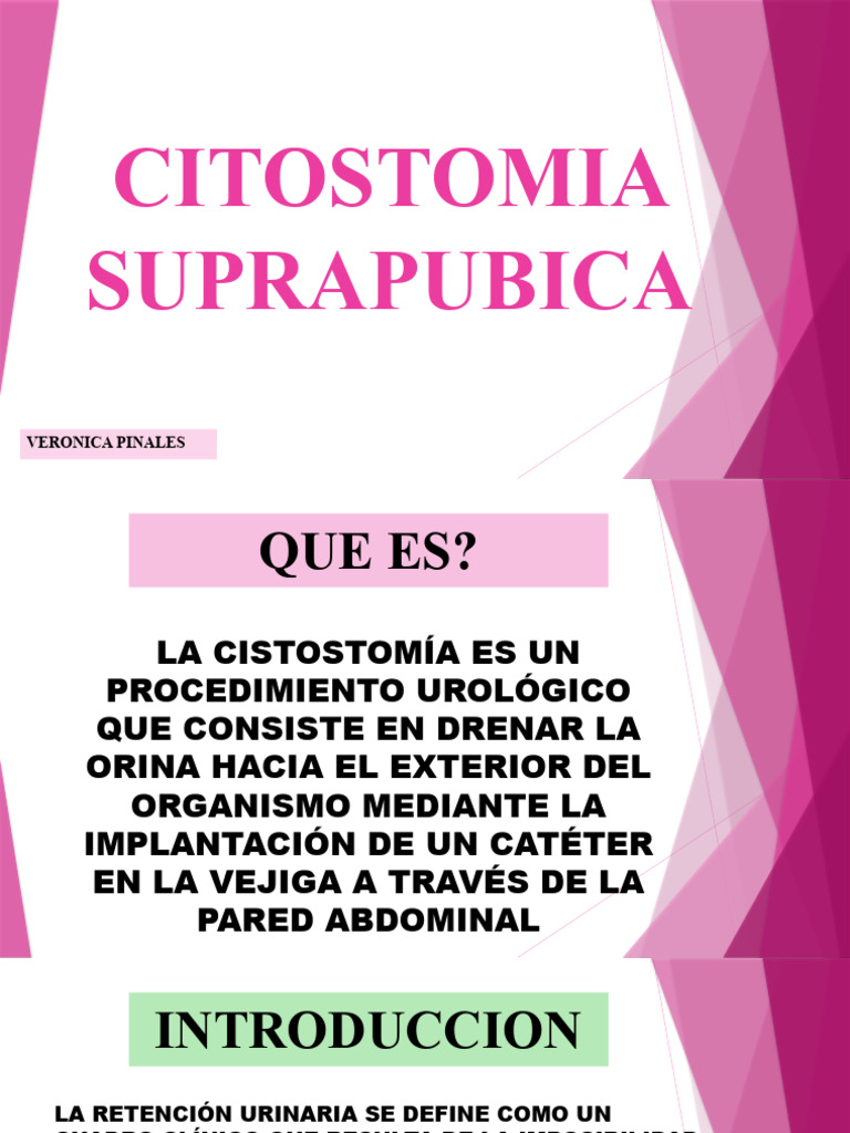 Citostomia Suprapubica | PDF | Causas de la muerte | Sistema urinario