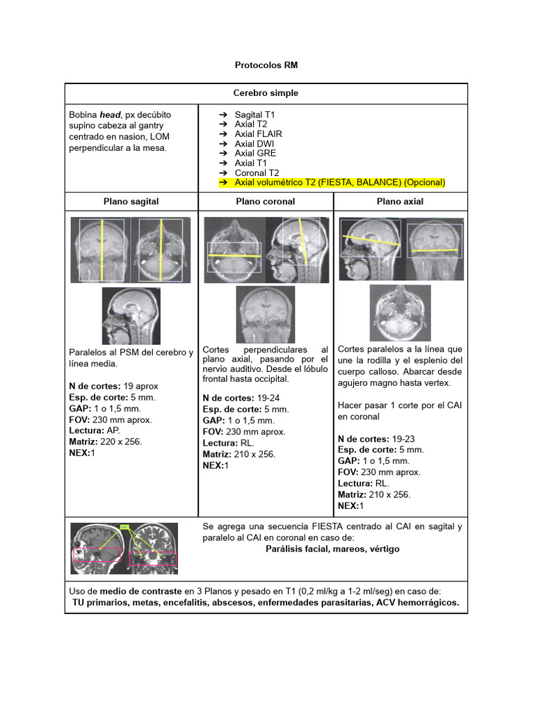 Protocolos RM | PDF | Glándula pituitaria | La columna vertebral