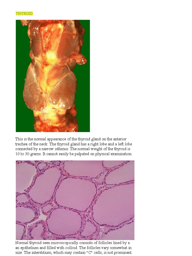 ENDOCRINE PATHOLOGY Webpath | PDF | Thyroid | Adrenal Gland