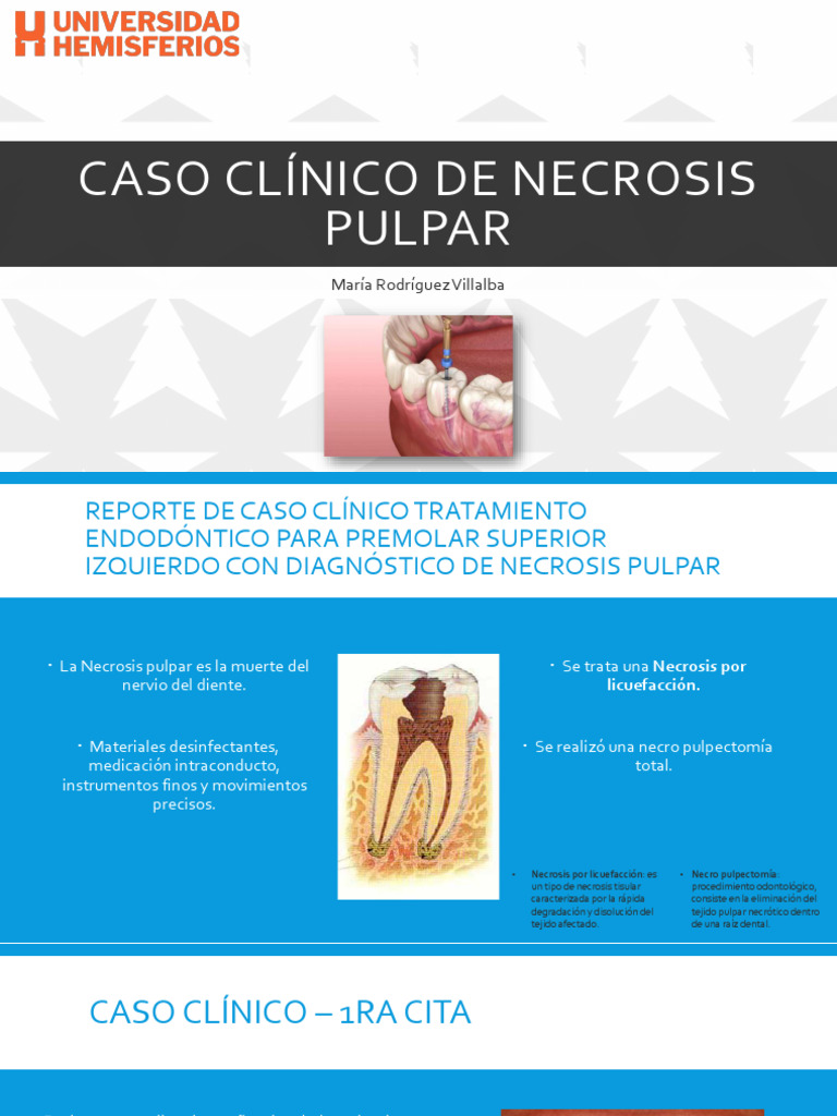 Caso clínico necrosis pulpar.- MRodriguez | PDF | Cuidado de la salud ...
