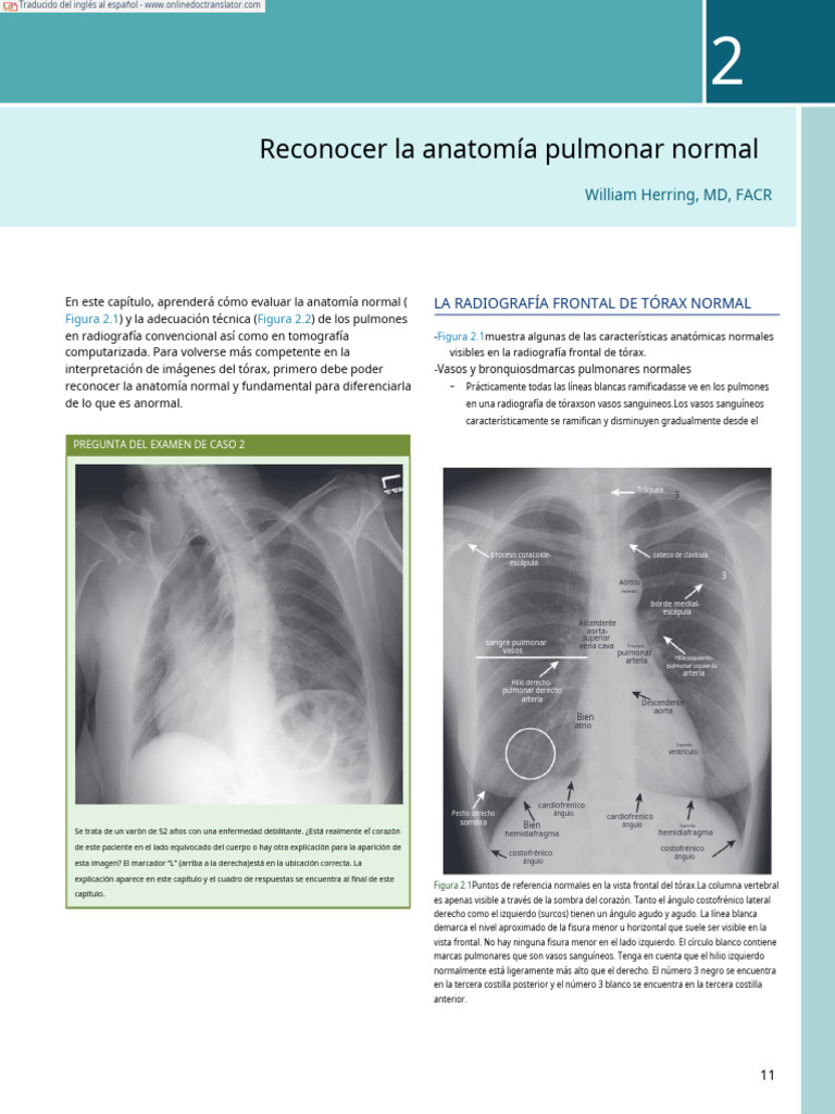 Learning Radiology - 5ed 2024 - .En - Es | PDF | Tórax | Pulmón