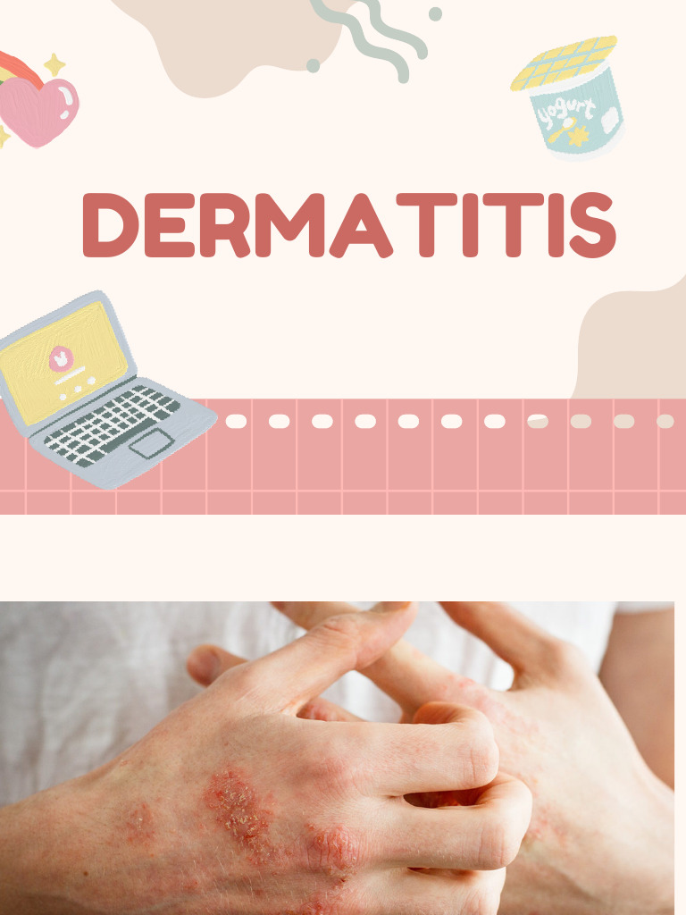 DERMATITIS | PDF