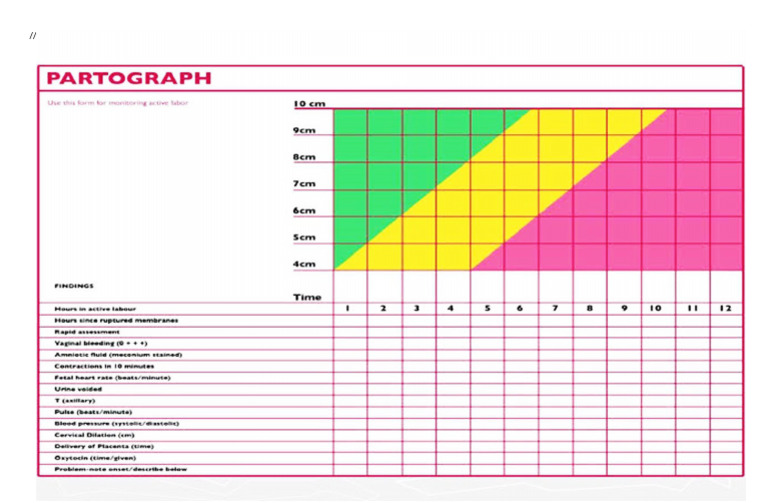 Partograph 1 | PDF