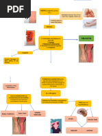 Cellulitis Pathophysiology Overview | PDF | Inflammation | Medical ...