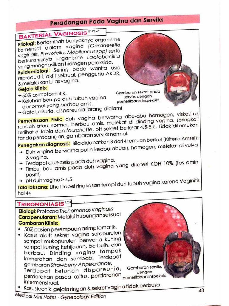 Mini Note Ginekologi LBM 2 | PDF