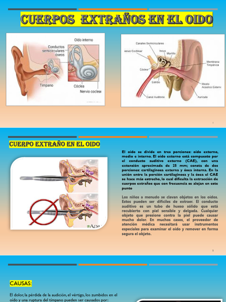 Cuerpos Extraños En El Oído Guía De Primeros Auxilios Pdf Oído