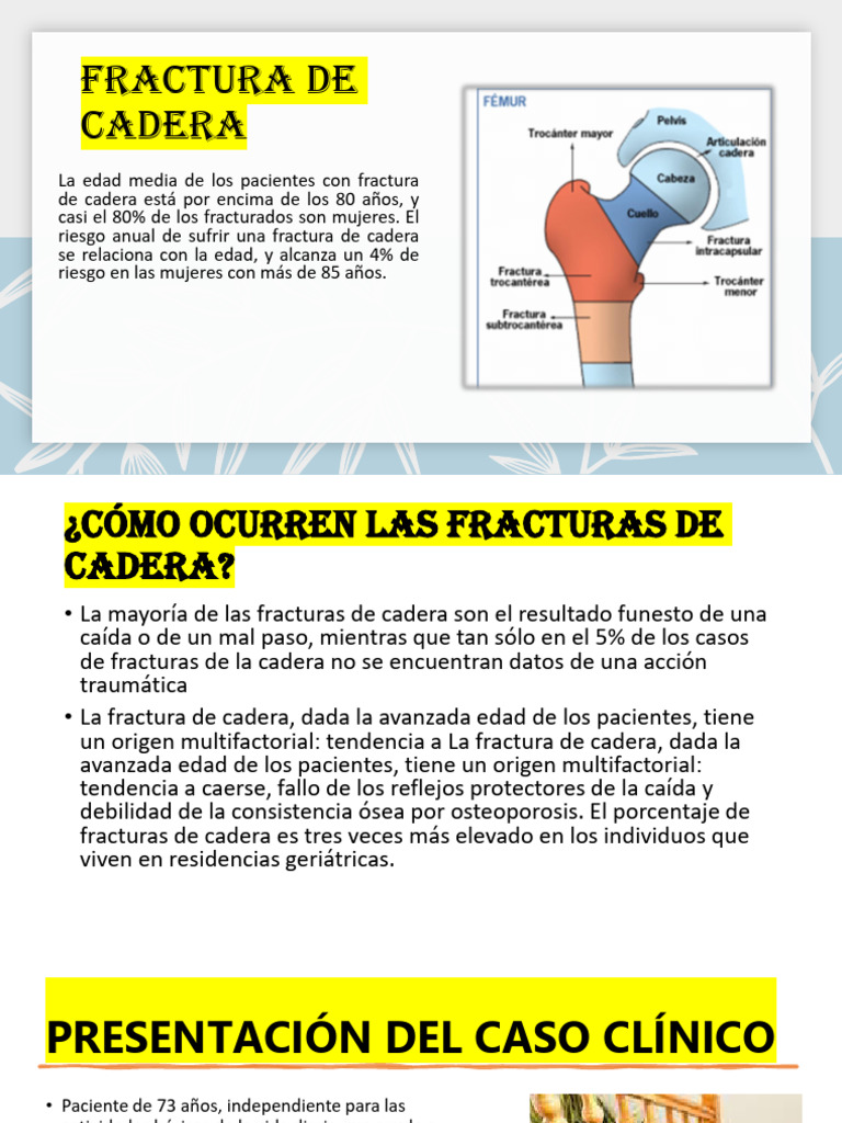 Fractura de Cadera | PDF | Osteoporosis | Medicina CLINICA