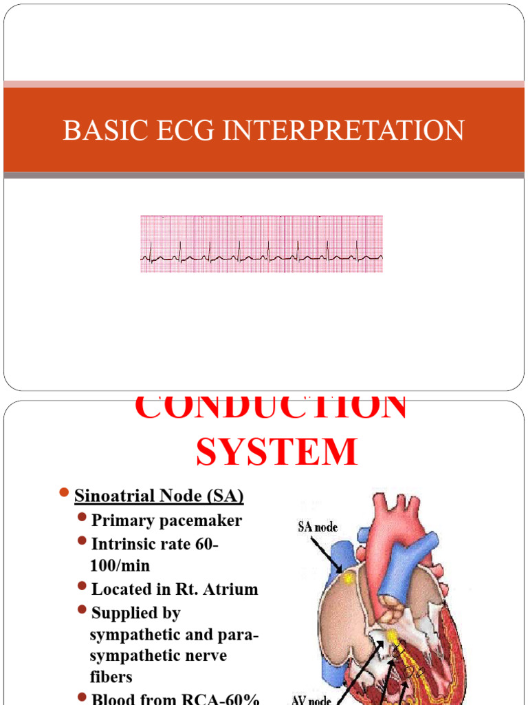 Basic ECG Interpretation | PDF | Electrocardiography | Clinical Medicine
