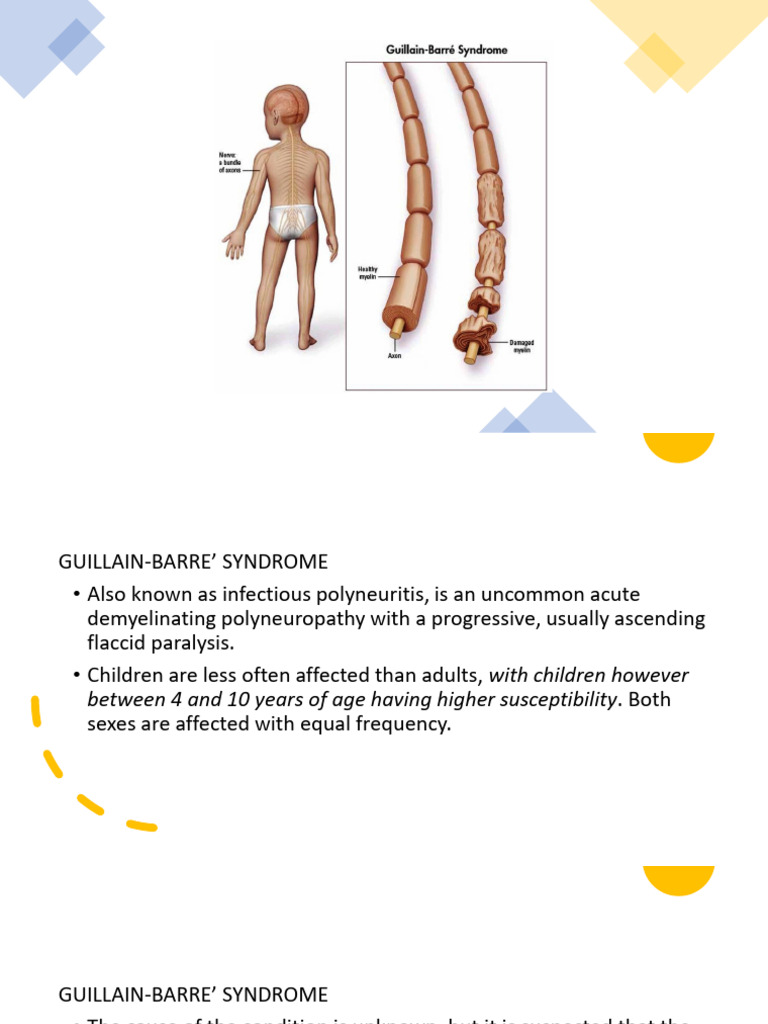 Guillain-Barre Syndrome | PDF | Clinical Medicine | Medical Specialties