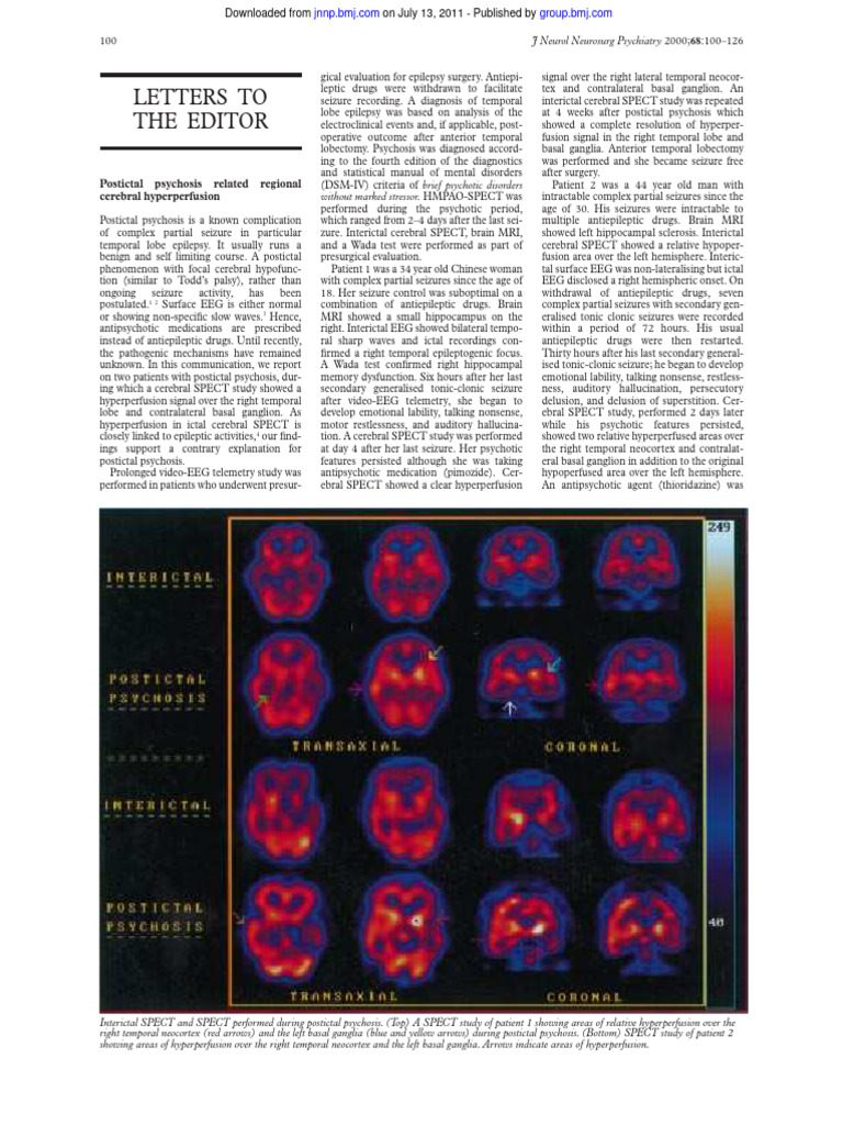 Fahrs Disease and Aspergers Syndrome in | PDF | Epilepsy | Psychosis
