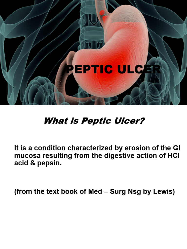 Peptic Ulcer | PDF | Stomach | Digestion