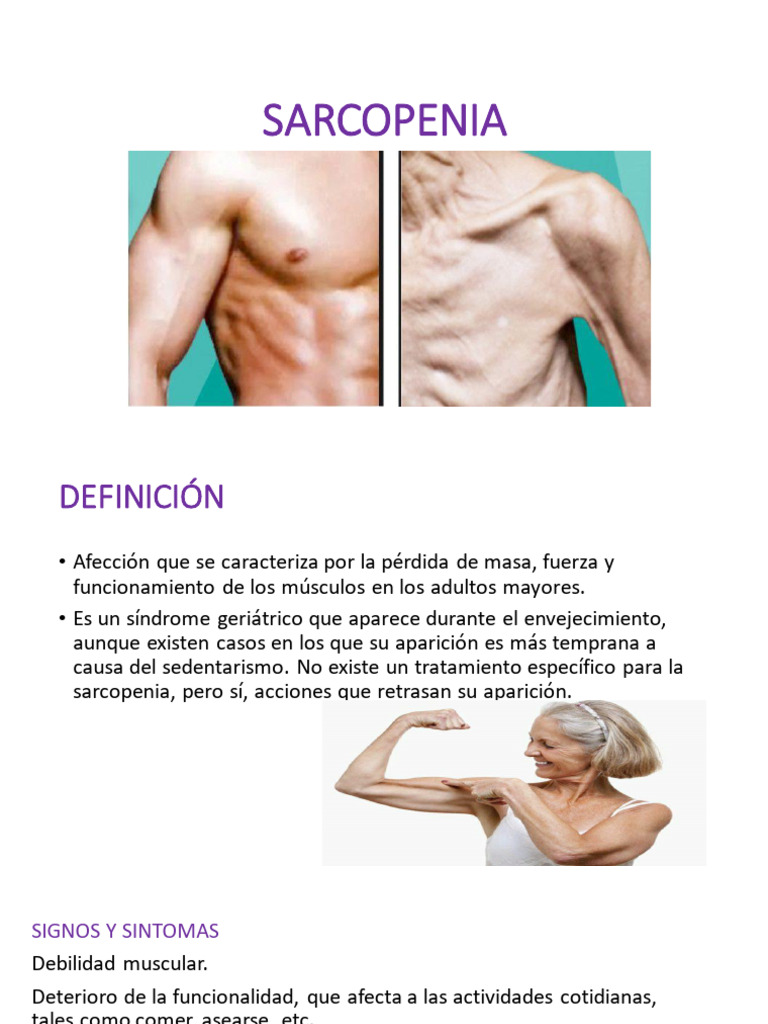 SARCOPENIA | PDF