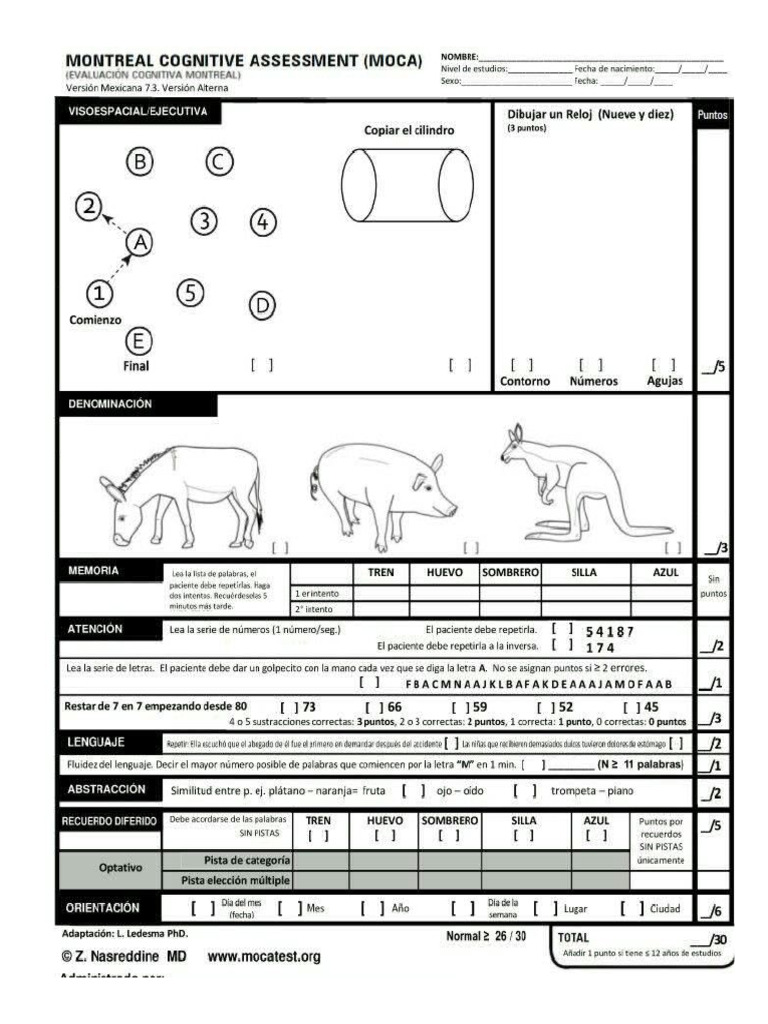 MOCA Alterno | PDF