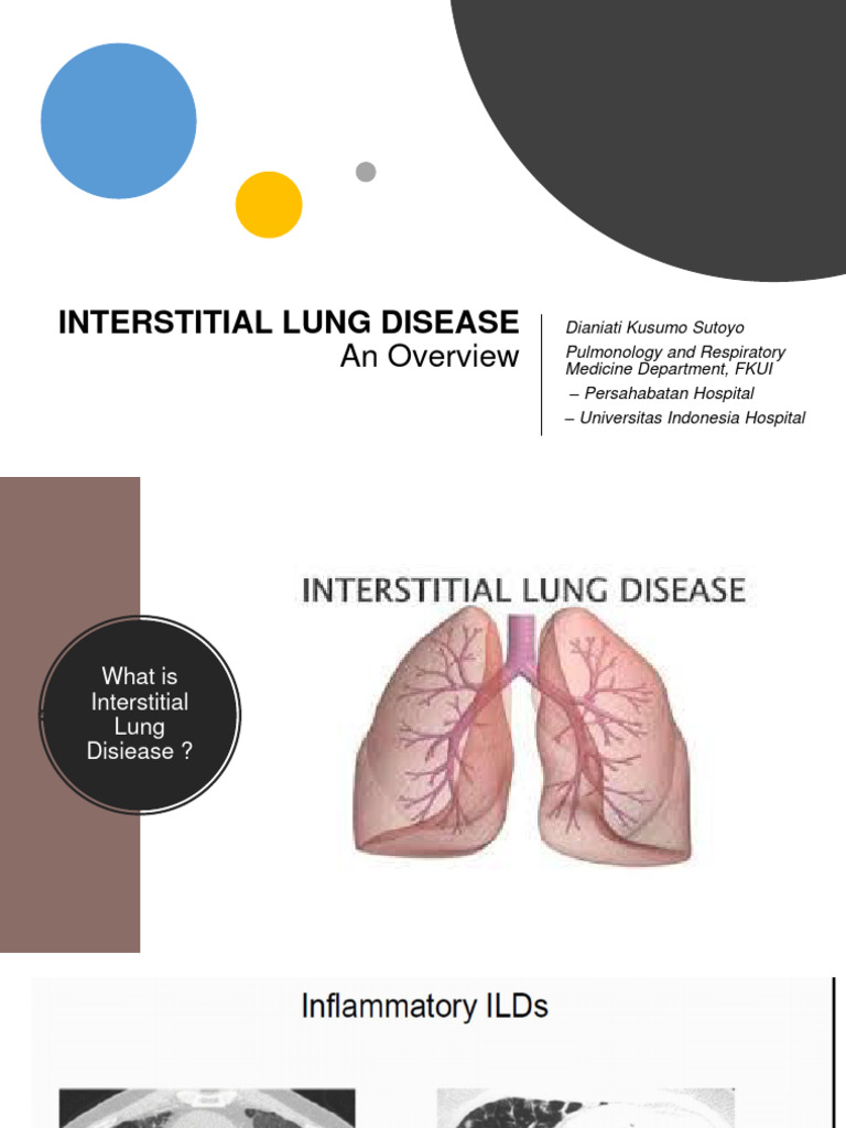 ILD - DR - Dianiati - Satsim9 | PDF | Medical Specialties | Diseases ...