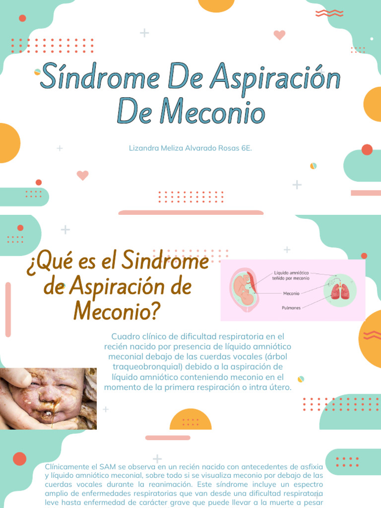 Síndrome de Aspiración de Meconio en Neonatos | PDF | Especialidades ...
