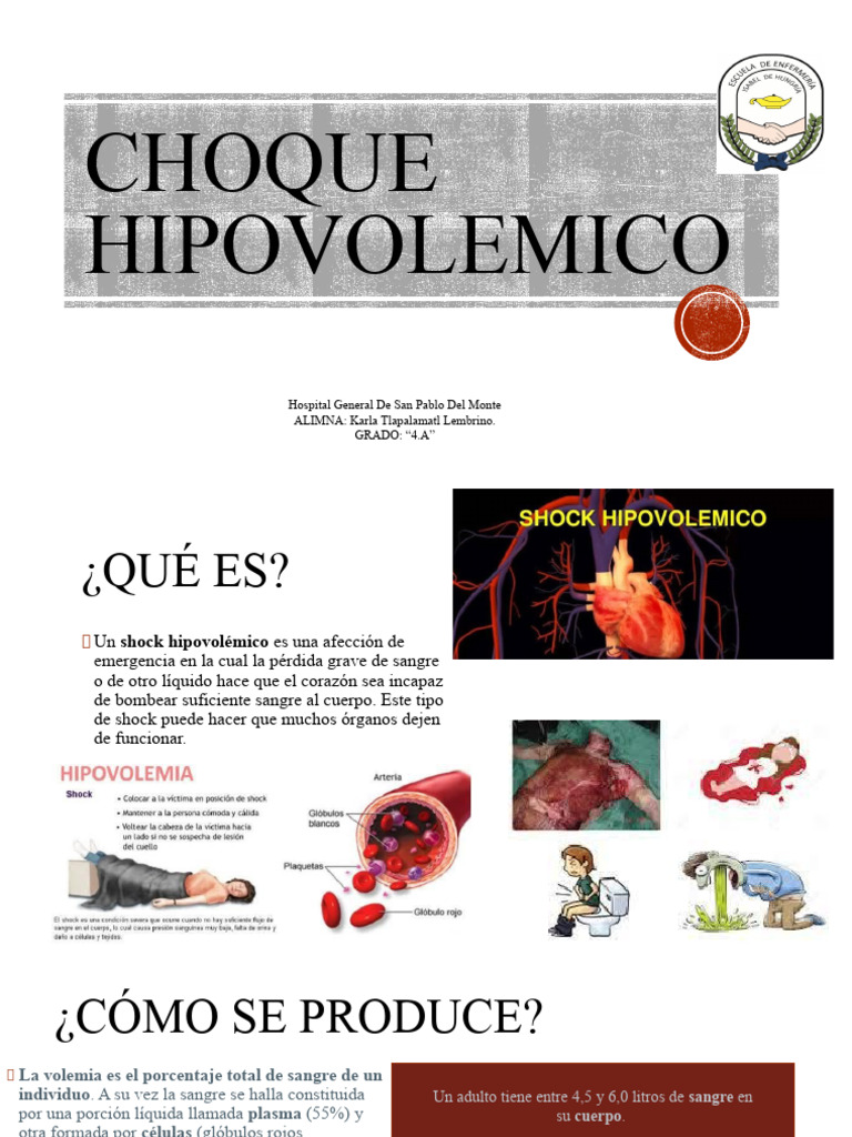 Shock Hipovolemico | PDF | Causas de la muerte | Enfermedades y trastornos