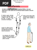 Tipos de Marcha | PDF | Sistema musculoesquelético | Enfermedades y ...
