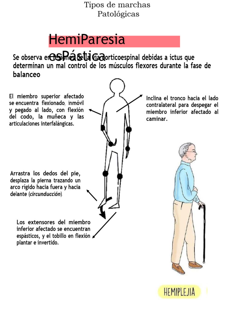 Tipos de Marchas Patológicas | PDF | Pie | Pierna humana