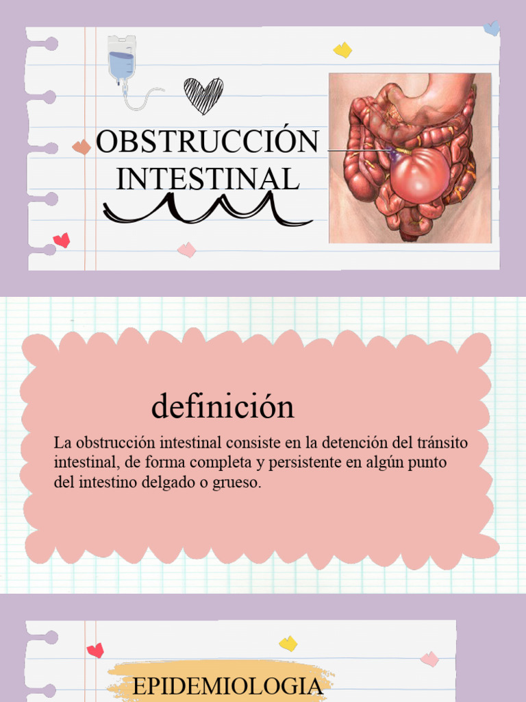 Obstrucción Intestinal | PDF | Enfermedades y trastornos | Causas de la ...