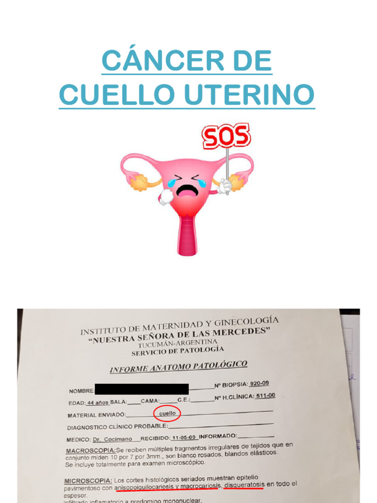 Cancer de Cuello Uterino - 2022 | PDF | Neoplasias | Enfermedades y trastornos