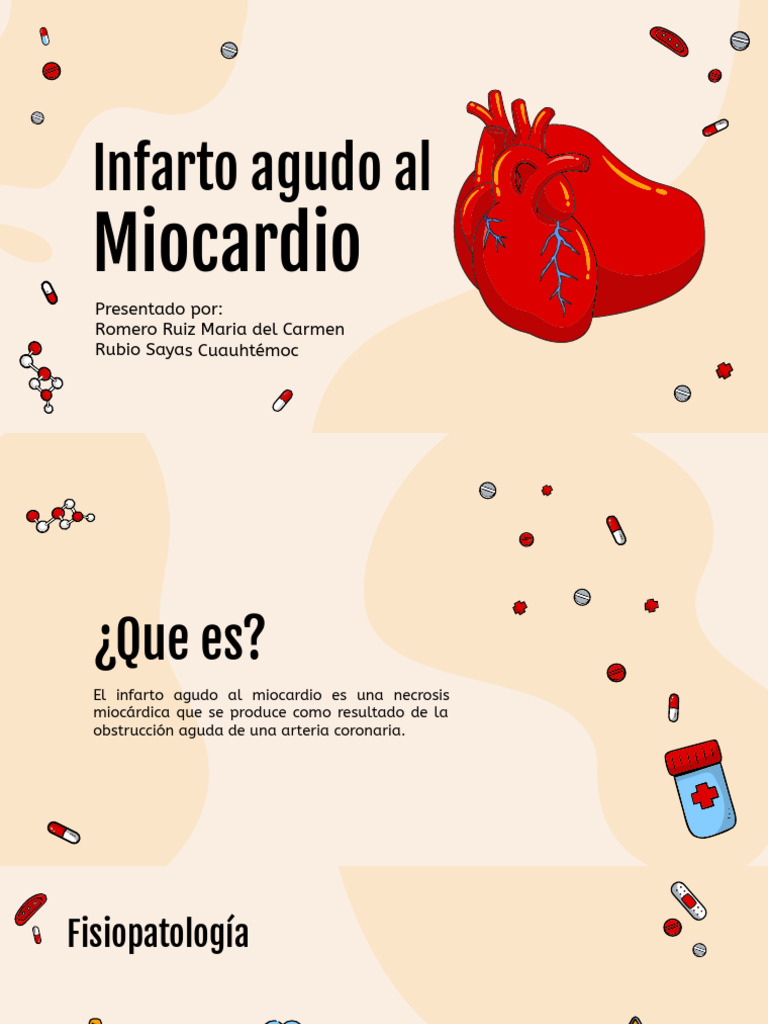 Infarto Agudo al Miocardio: Síntomas y Tratamiento | PDF | Infarto de ...