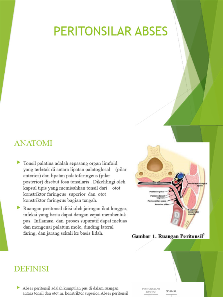 Abses Peritonsil: Definisi dan Penanganan | PDF