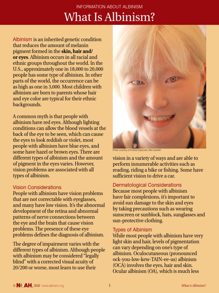 NOAH What Is Albinism - 2020 - Low Res | PDF | Clinical Medicine | Medical Specialties