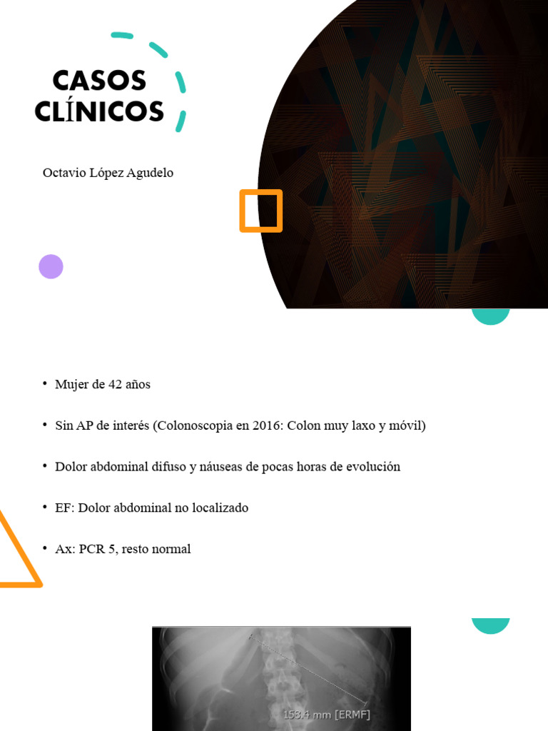 Volvulo Ciego | PDF | Intestino grueso | Abdomen