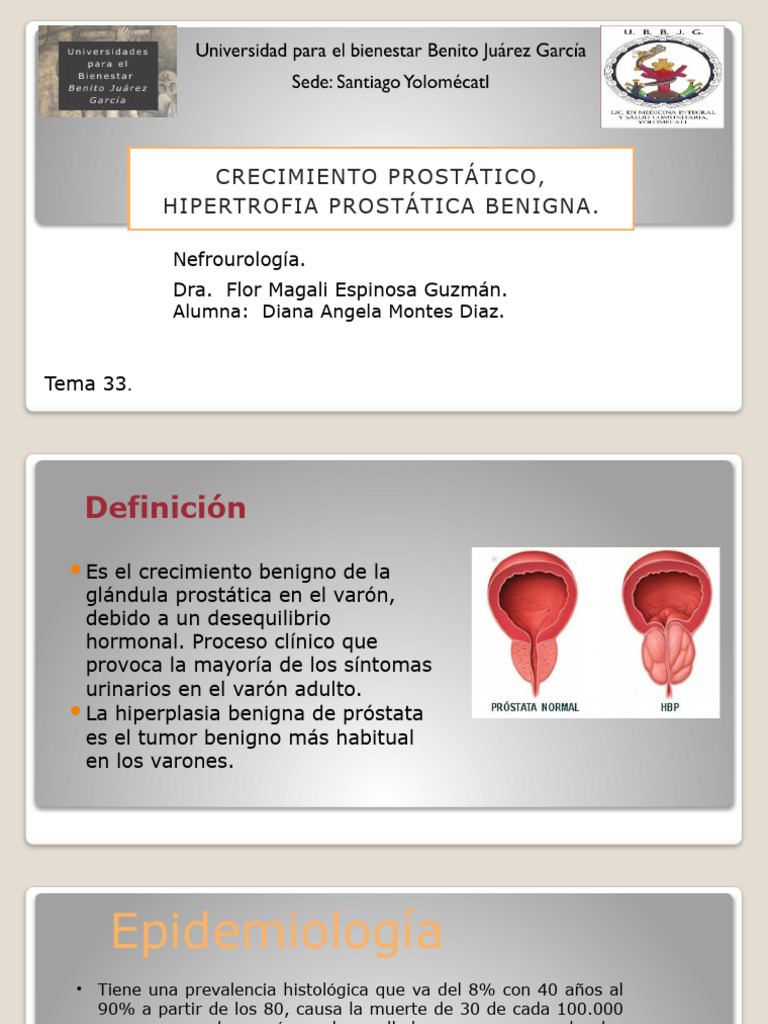Hipertrofia Prostática Benigna: Causas y Tratamientos | PDF | Cancer de ...