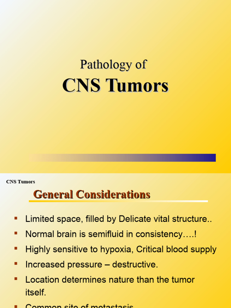 L75 - Pathology of CNS Tumors | PDF | Brain Tumor | Central Nervous System