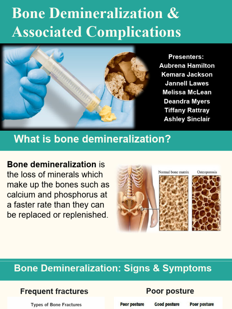 Bone Demineralization & Associated Complications | PDF | Bone ...