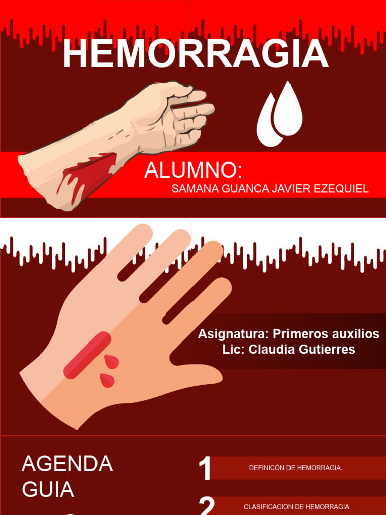 1 Hemorragia Primeros Auxilios | PDF | Sangrado | Primeros auxilios
