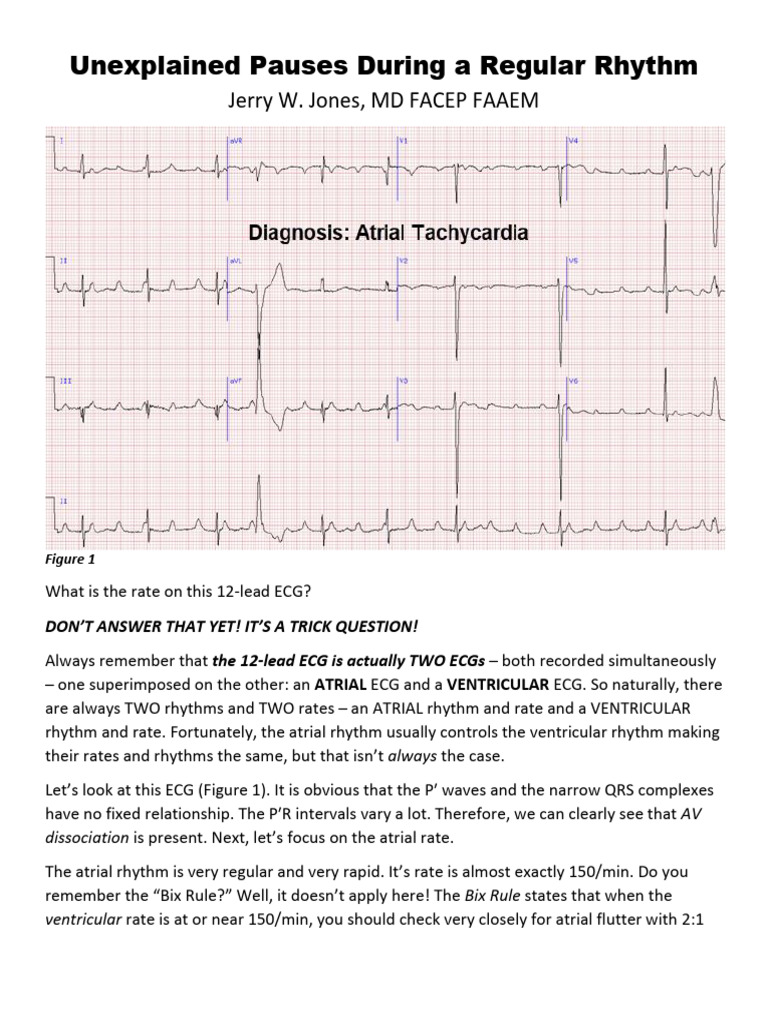 Unexplained Pauses During A Regular Rhythm 1680087484 | PDF
