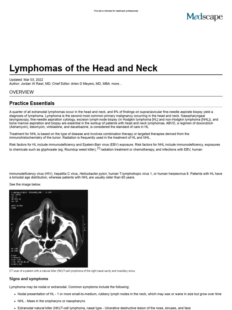 Lymphomas of The Head and Neck - Practice Essentials, Background ...