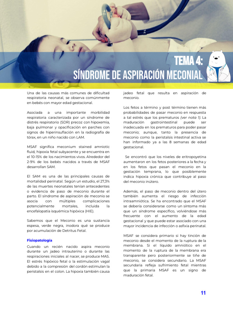 4 Sindrome de Aspiracion Meconial | Descargar gratis PDF | Feto | Medicina