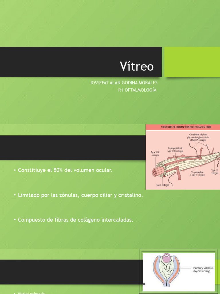 Vítreo | PDF | Ojo humano | Órganos sensoriales