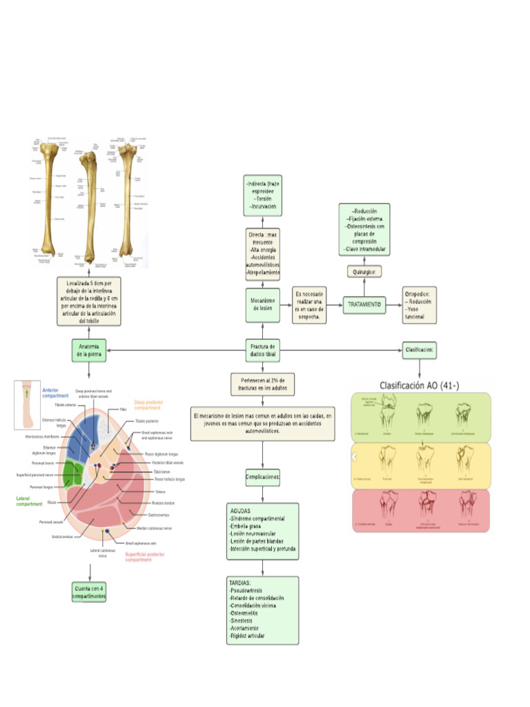 Fracturas de Diáfisis Tibial | PDF | Medicina CLINICA | Anatomía humana