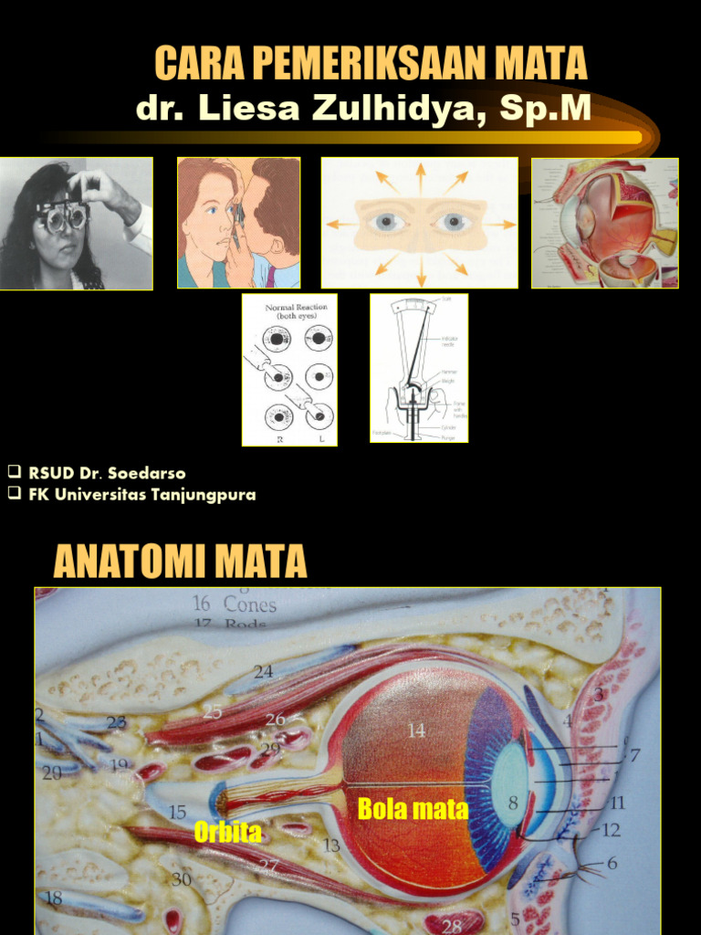 Pemeriksaan Mata 1 | PDF | Sensory Organs | Causes Of Death