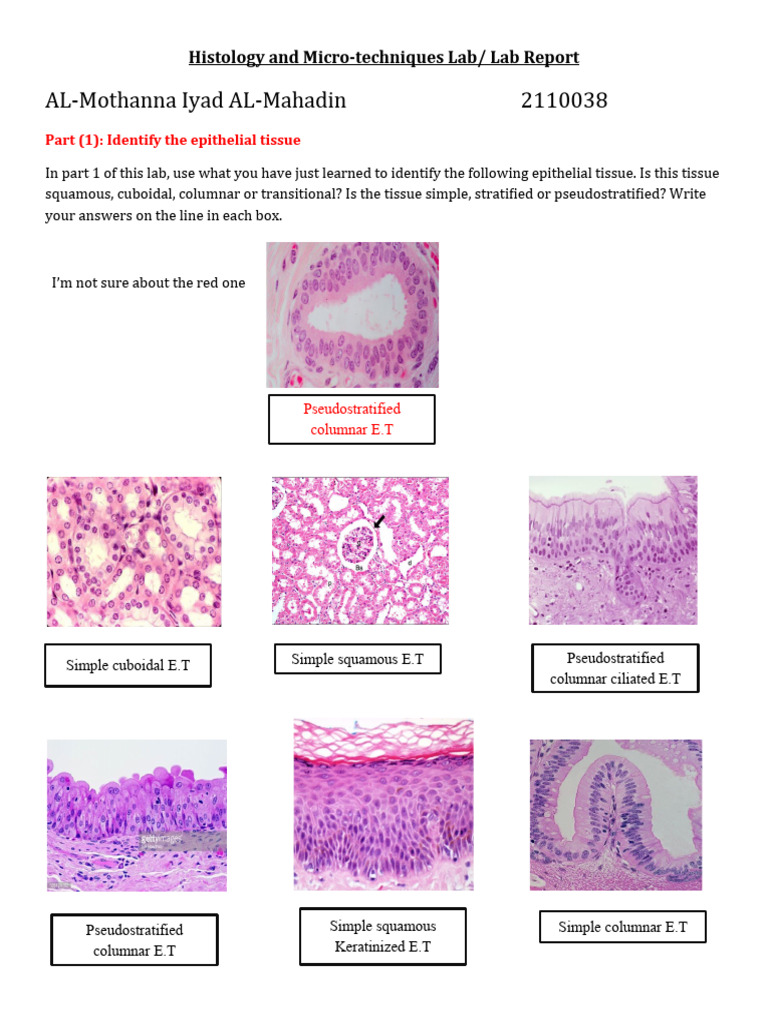 2 Epithelial Tissue Report Pdf