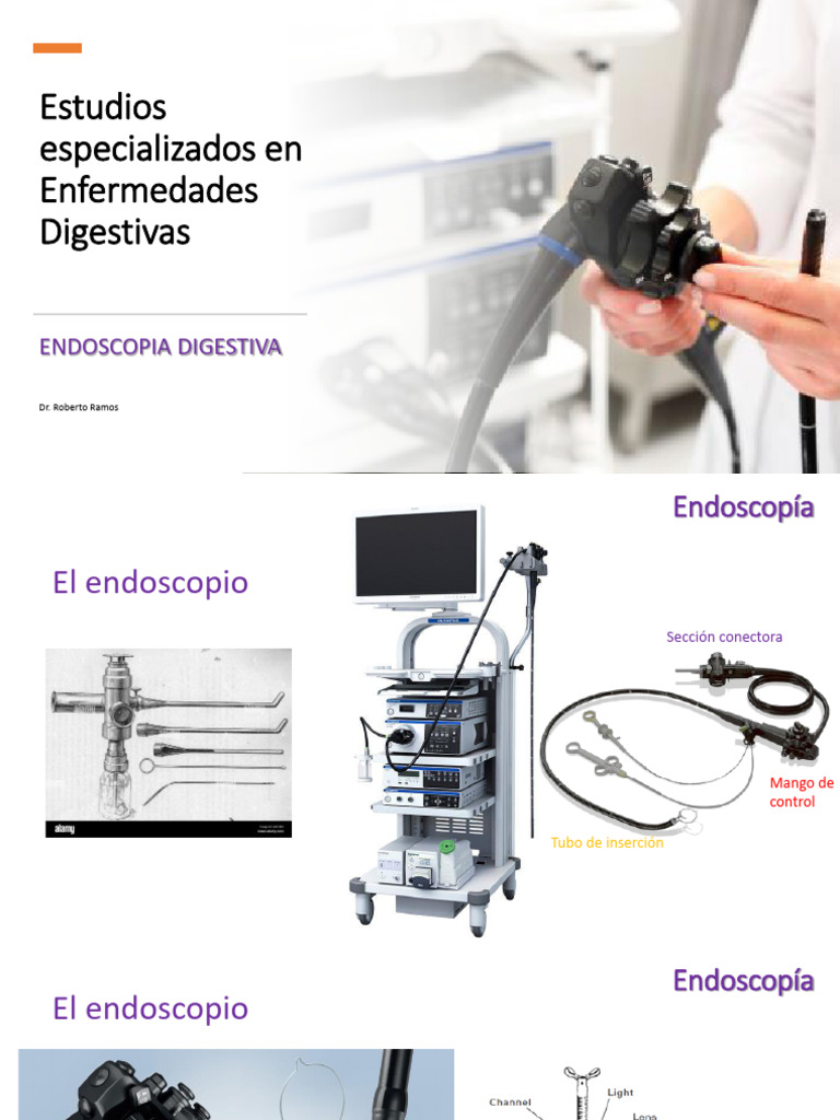 Endoscopia Digestiva | PDF | Cáncer colonrectal | Endoscopia