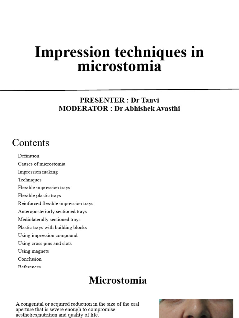 Impression Techniques for Microstomia | PDF